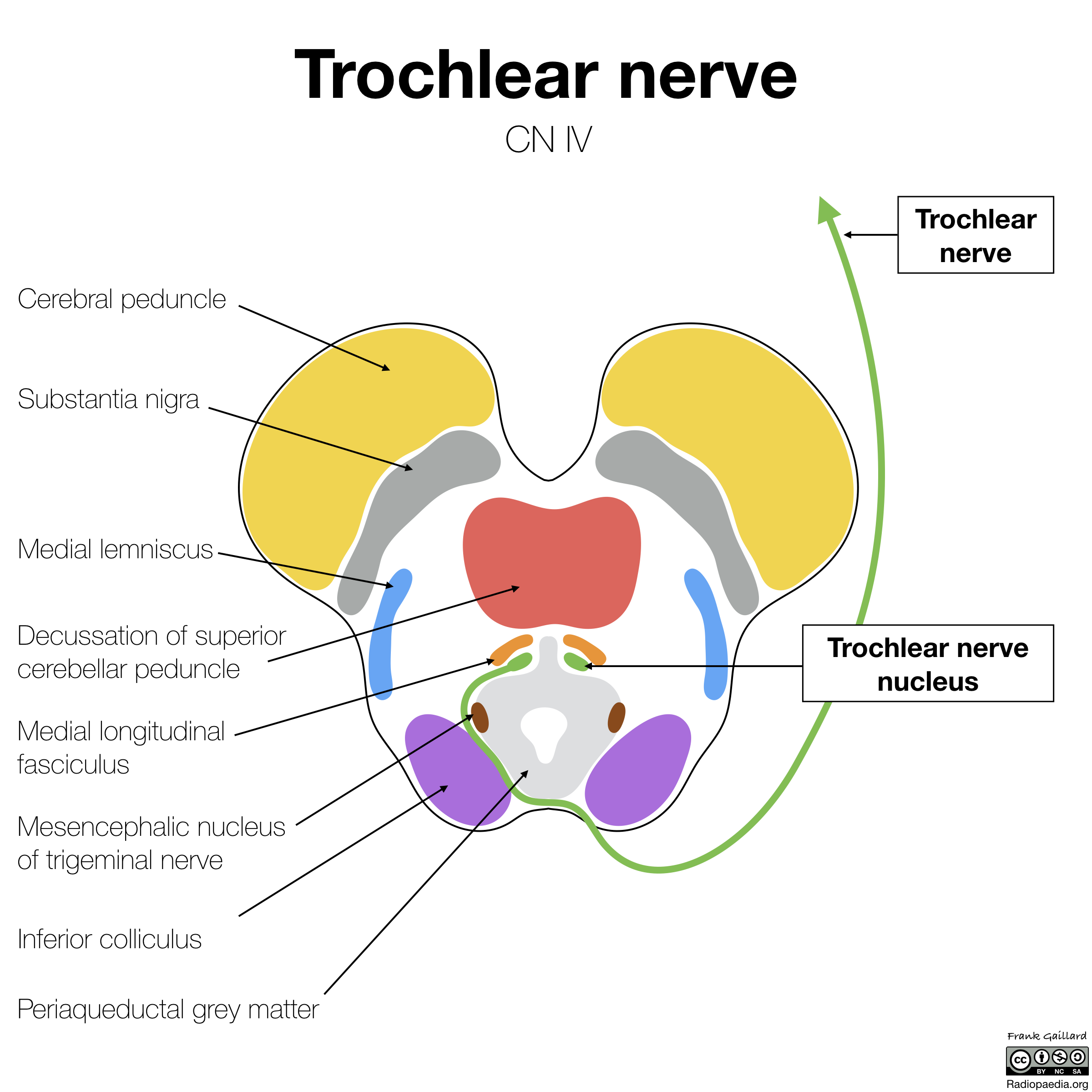Radiopaedia - Drawing Midbrain at level of trochlear nerve - English ...