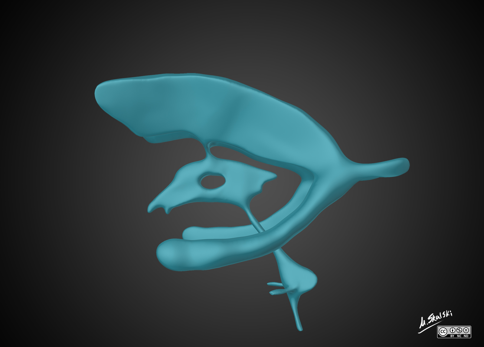 Radiopaedia - Drawing Anatomy of the brain ventricles - no labels ...