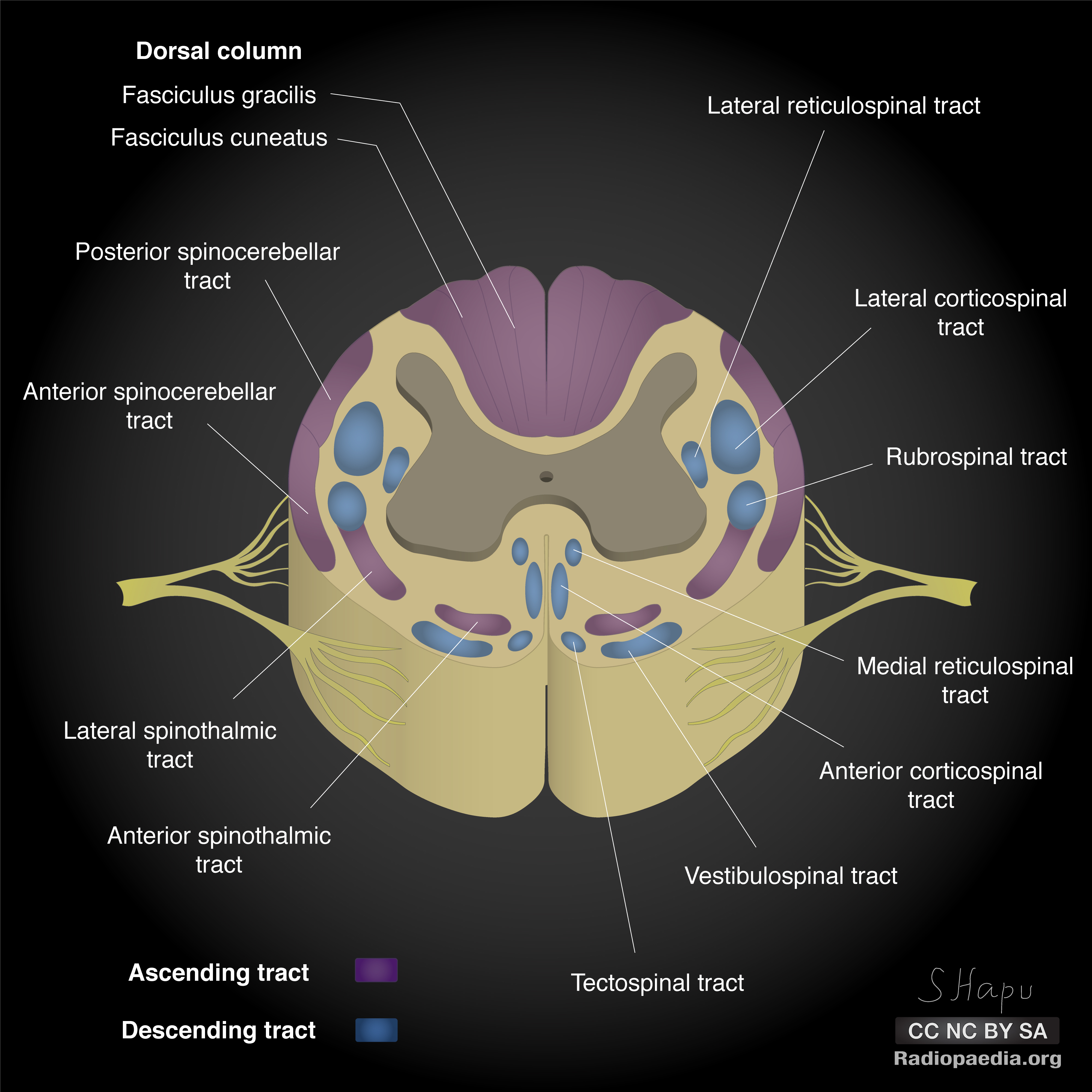 Radiopaedia - Drawing Tracts of the spinal cord from anterior - English ...