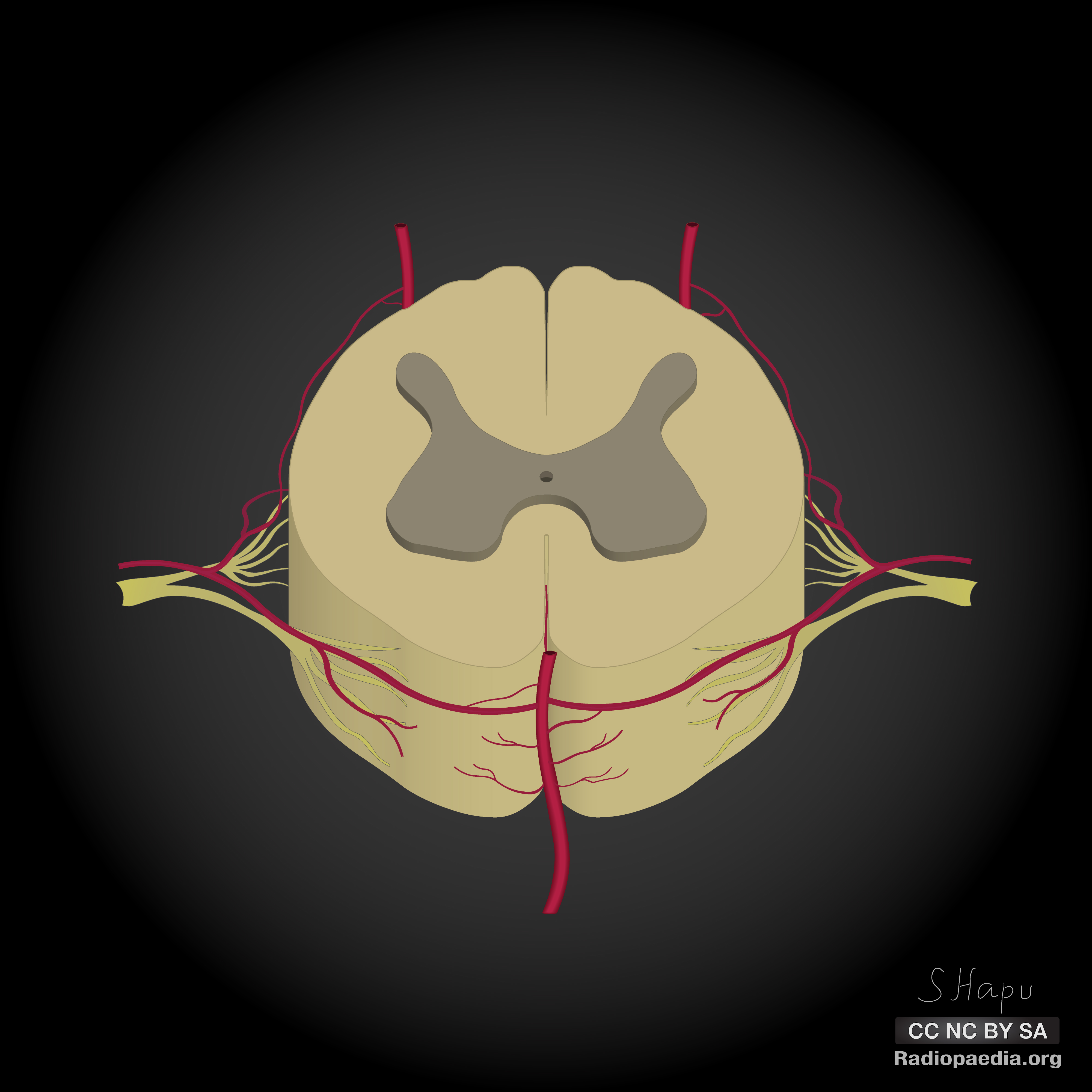 Radiopaedia - Drawing Arteries of the spinal cord - no labels | AnatomyTOOL