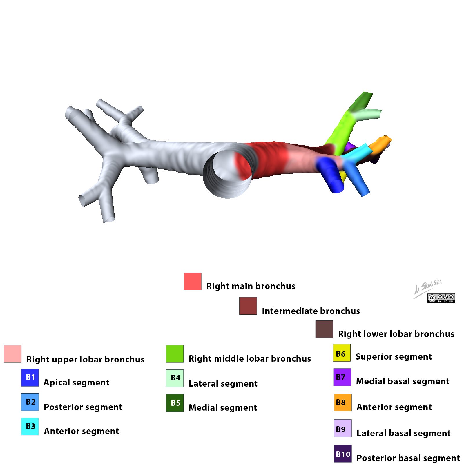 Radiopaedia - Drawing Right bronchial tree from superior - English ...