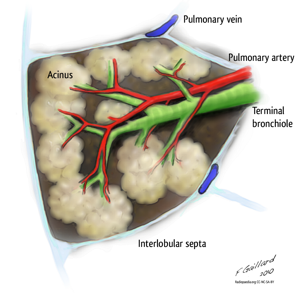 Radiopaedia - Drawing Secondary pulmonary lobule and related structures ...