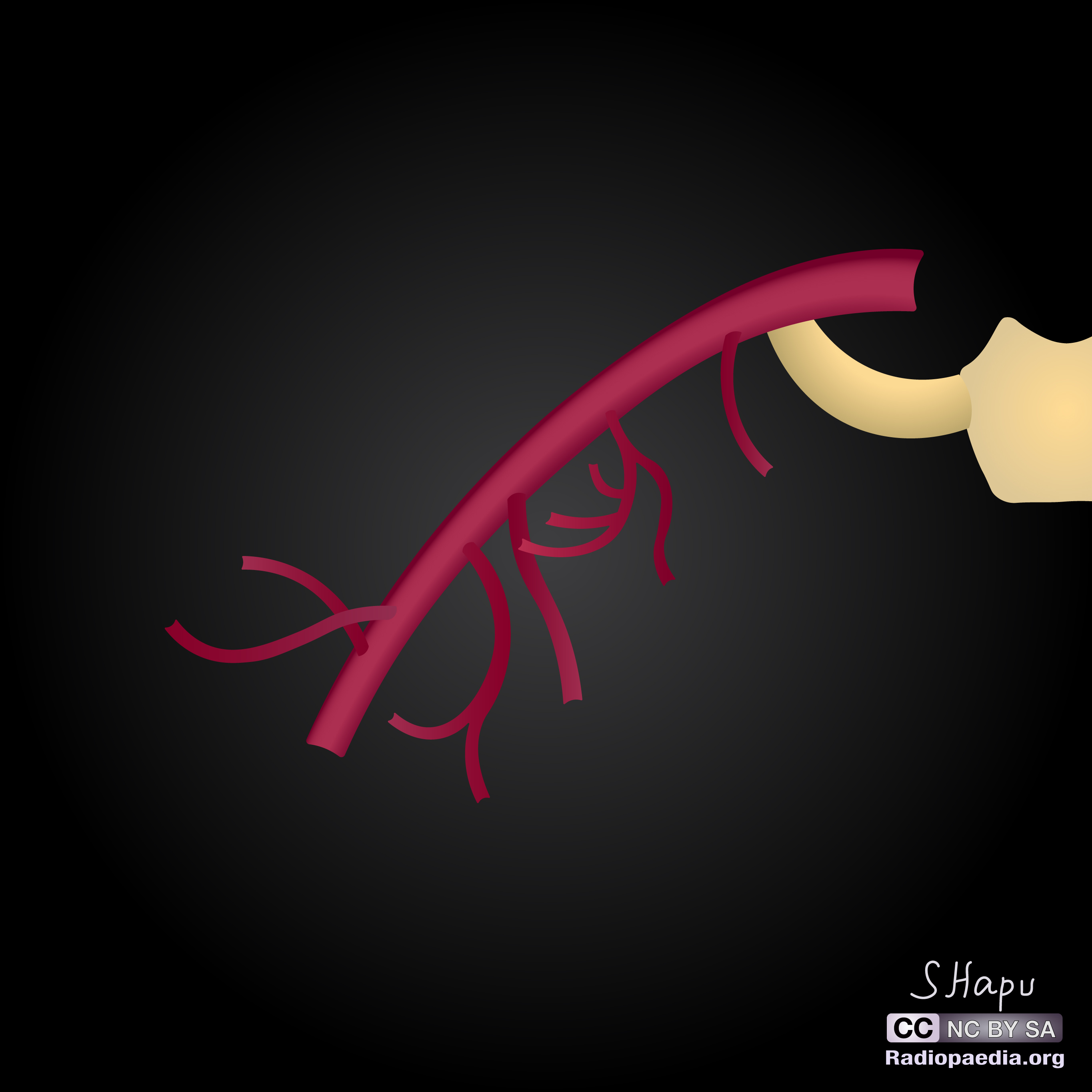 Radiopaedia - Drawing Segments and branches of axillary artery - no ...