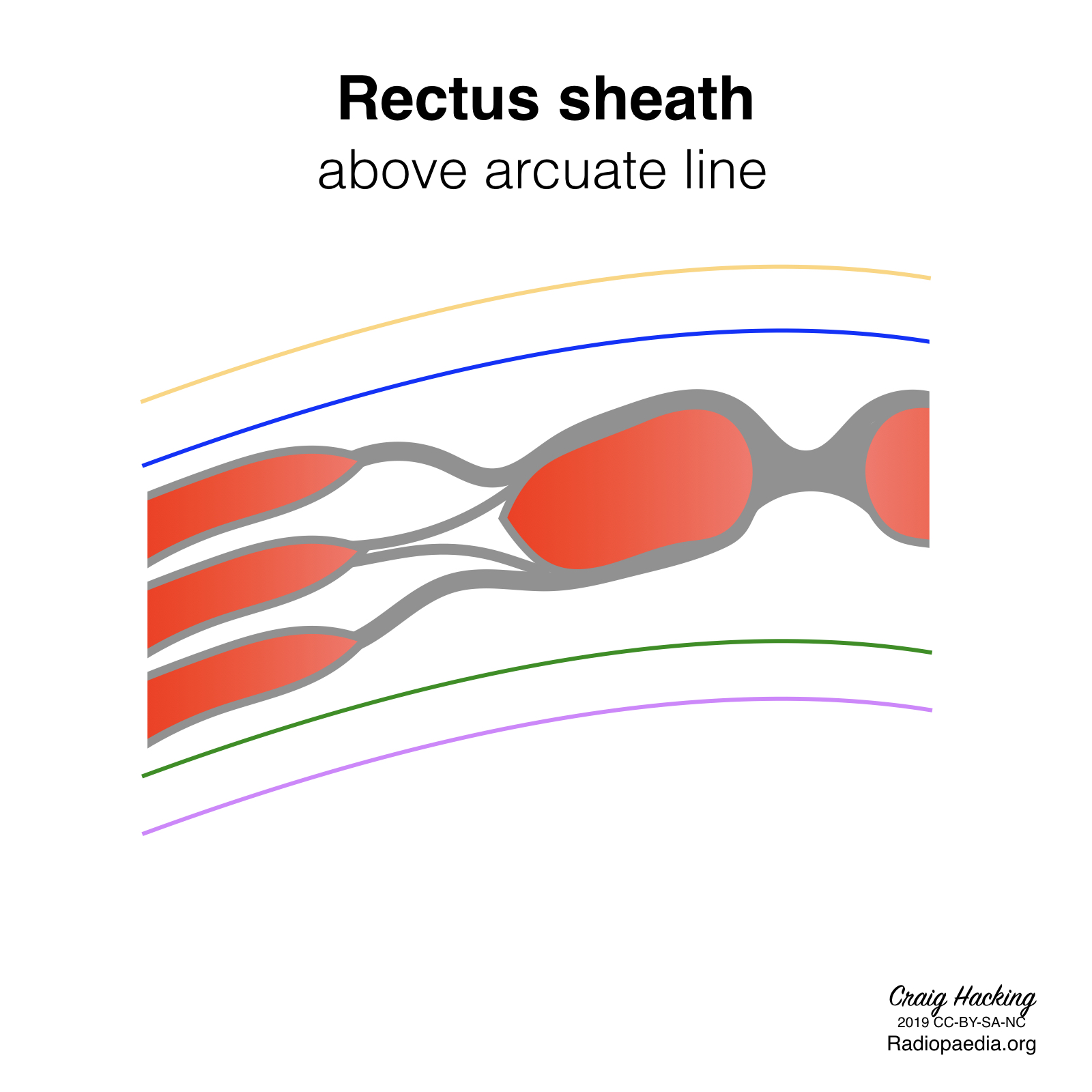 Radiopaedia - Drawing Rectus sheath above arcuate line - no labels ...