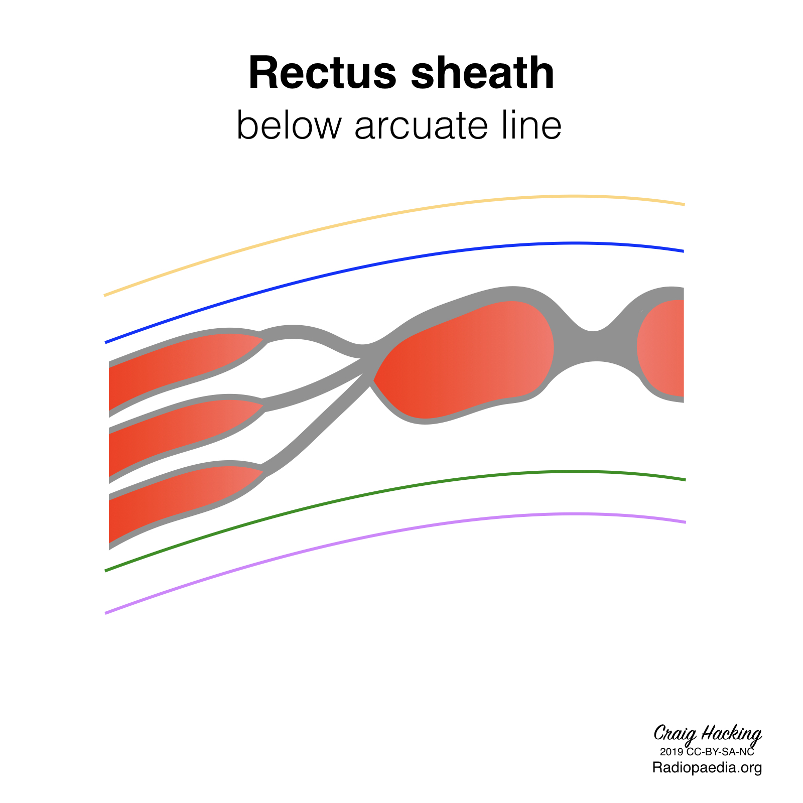 Radiopaedia - Drawing Rectus sheath below arcuate line - no labels ...