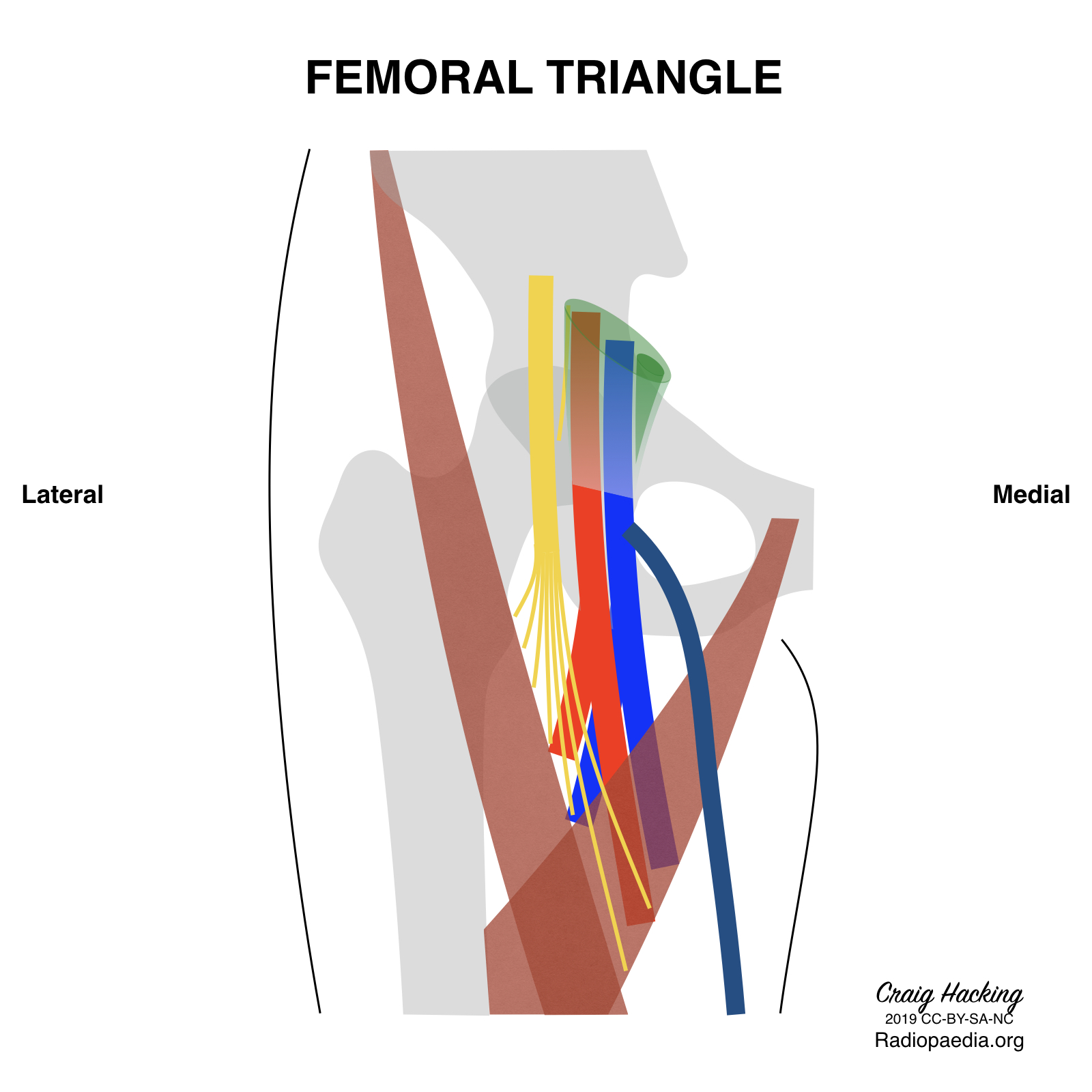Radiopaedia - Drawing Contents of the femoral triangle - no labels ...
