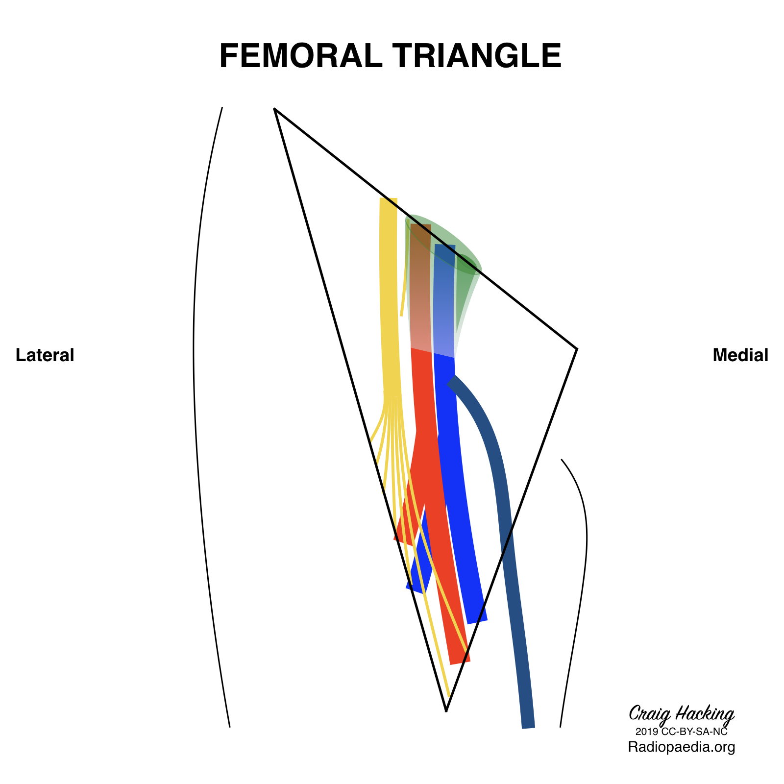 Radiopaedia - Drawing Femoral triangle schematic - no labels | AnatomyTOOL