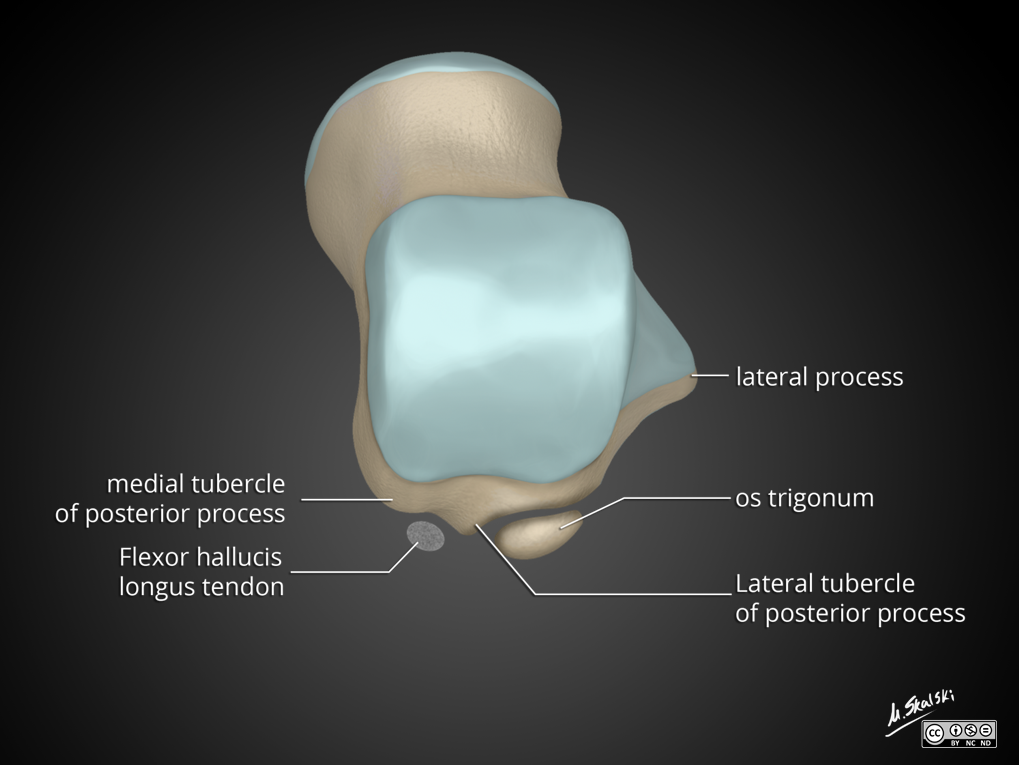 Radiopaedia - Drawing Os trigonum of talus - English labels | AnatomyTOOL