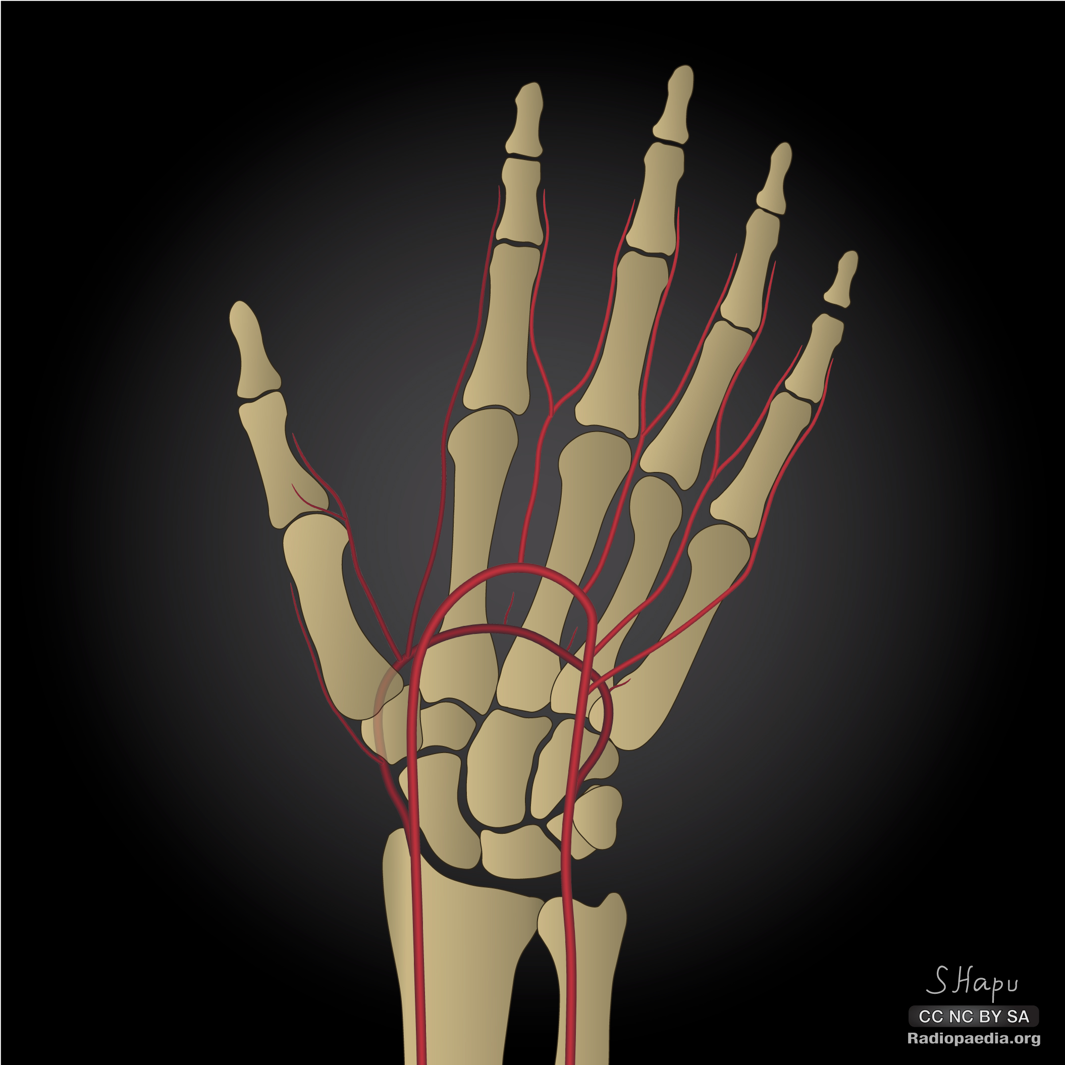 Radiopaedia - Drawing Arterial supply to the hand palmar view - no ...