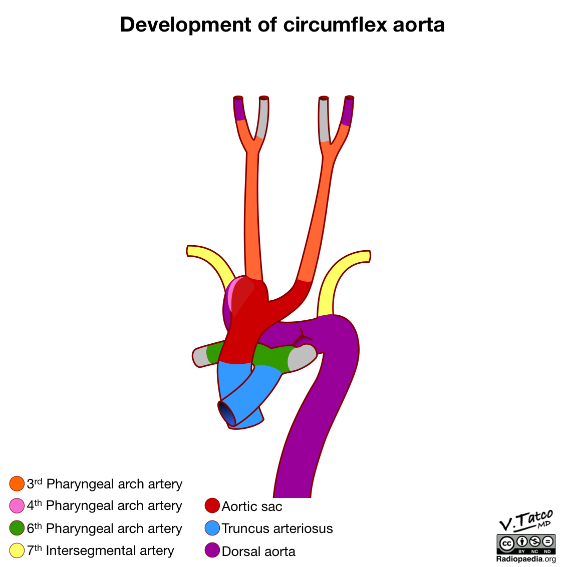 Radiopaedia - Drawing Development of circumflex aorta - no labels ...