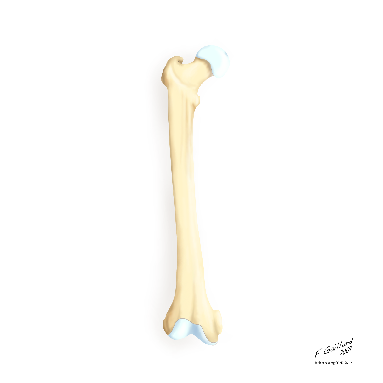 Radiopaedia - Drawing Femur anterior view - no labels | AnatomyTOOL