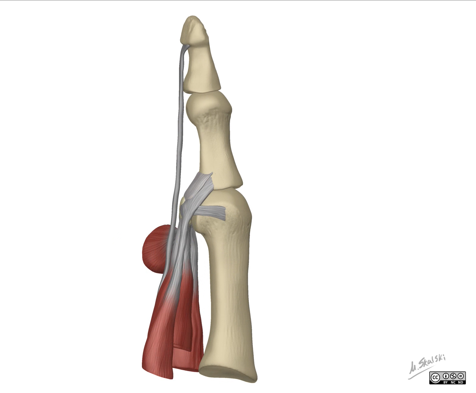 Radiopaedia - Drawing First metatarsophalangeal joint: medial view - no ...