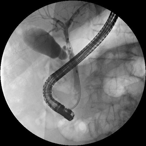 H5P Multichoice which structures on ERCP B | AnatomyTOOL