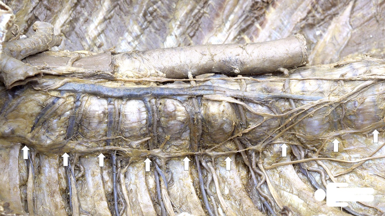 Autonome zenuwstelsel NL 6 - Dissectie beeld | AnatomyTOOL