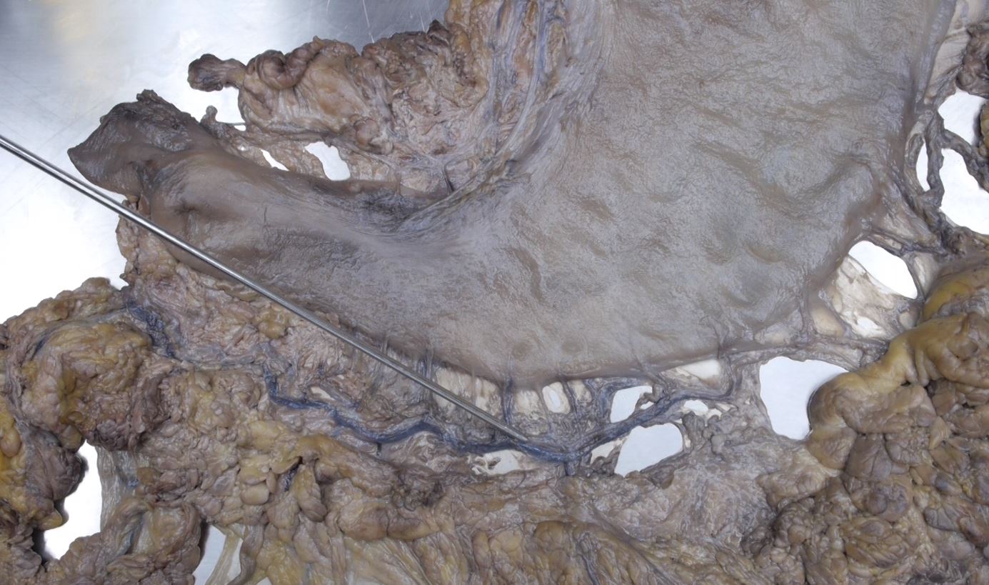 Stomach 9 Vascularization of the stomach | AnatomyTOOL