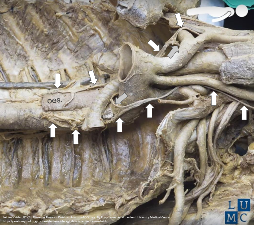 Autonomic nervous system 10 - Dissection | AnatomyTOOL