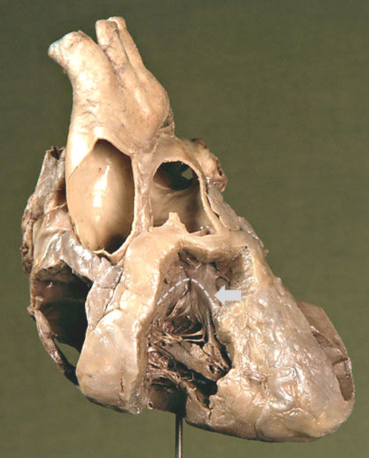 Heart characteristics 1 | AnatomyTOOL