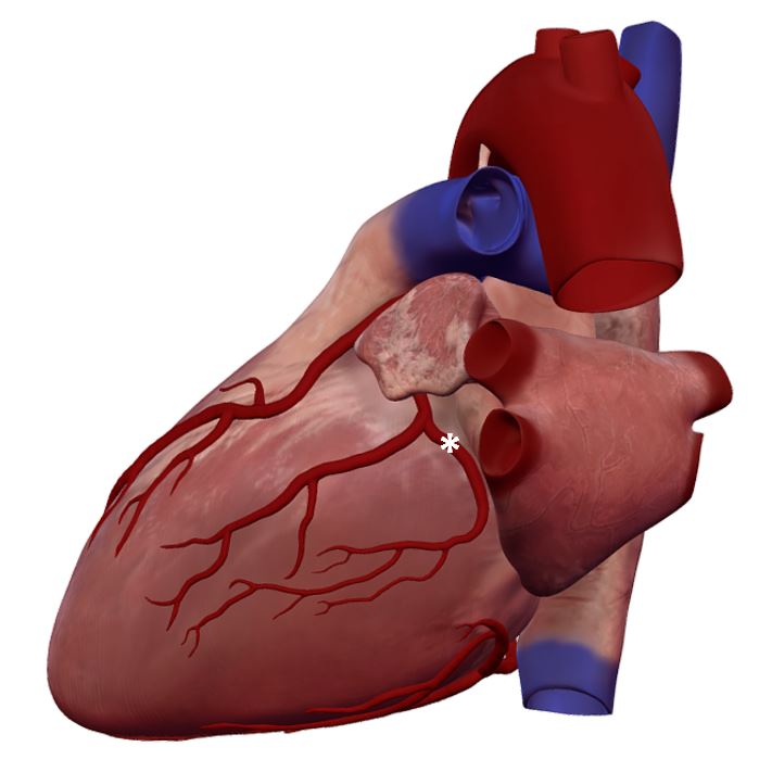 Coronary arteries 6b ENG | AnatomyTOOL