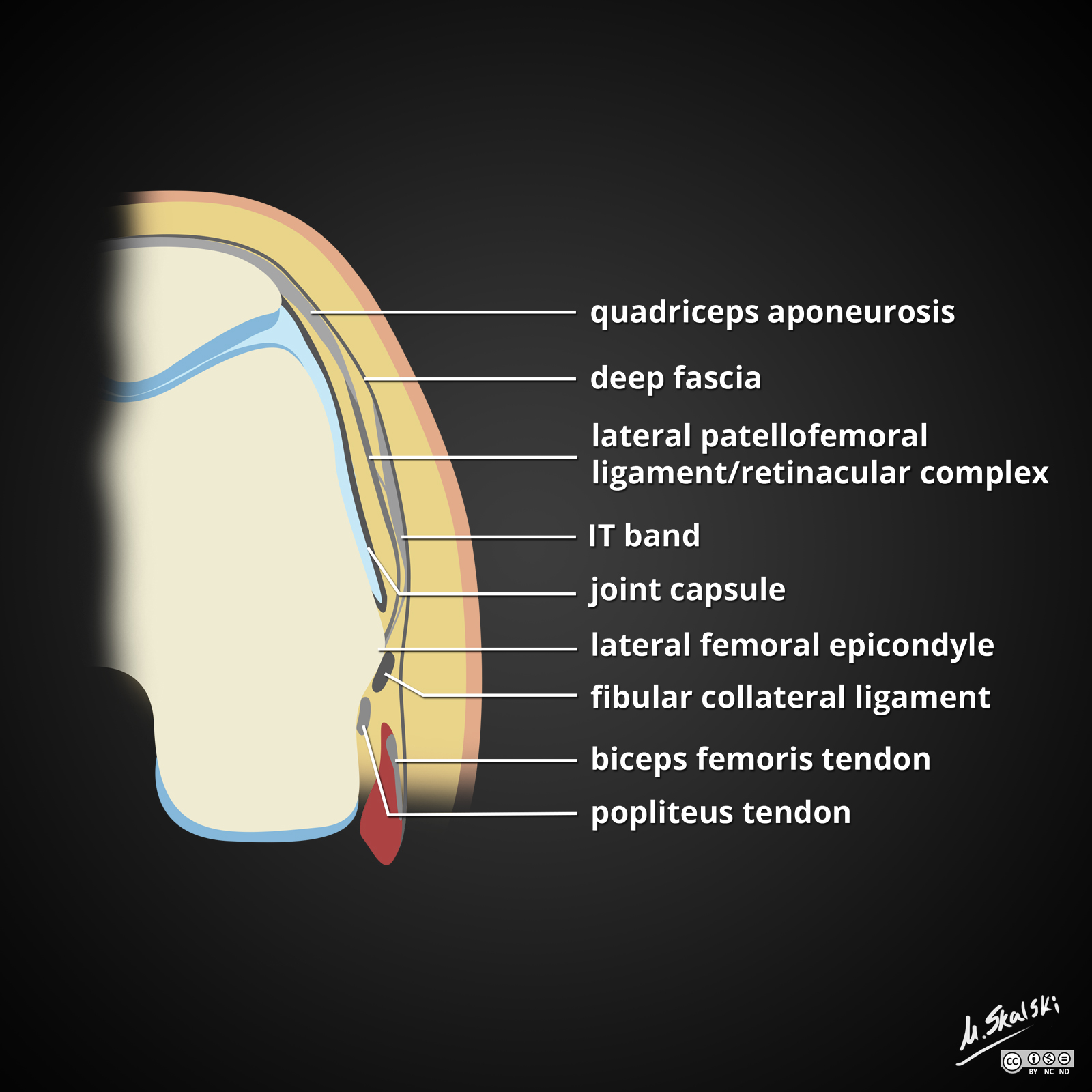 Radiopaedia - Drawing Transverse section of the distal femur - English ...