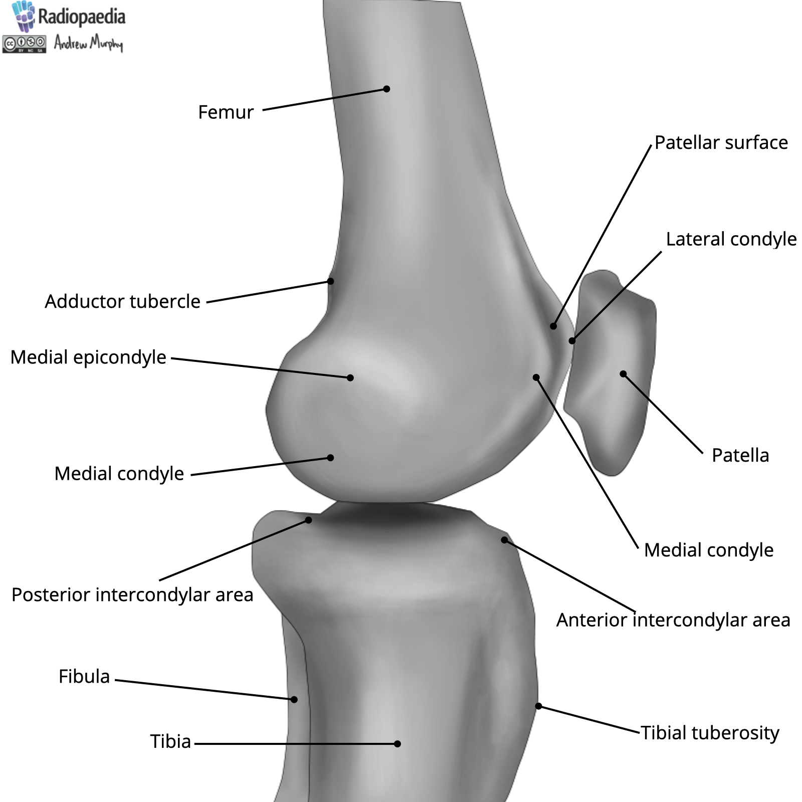 Radiopaedia - Drawing Bones of the knee joint: medial view - English ...