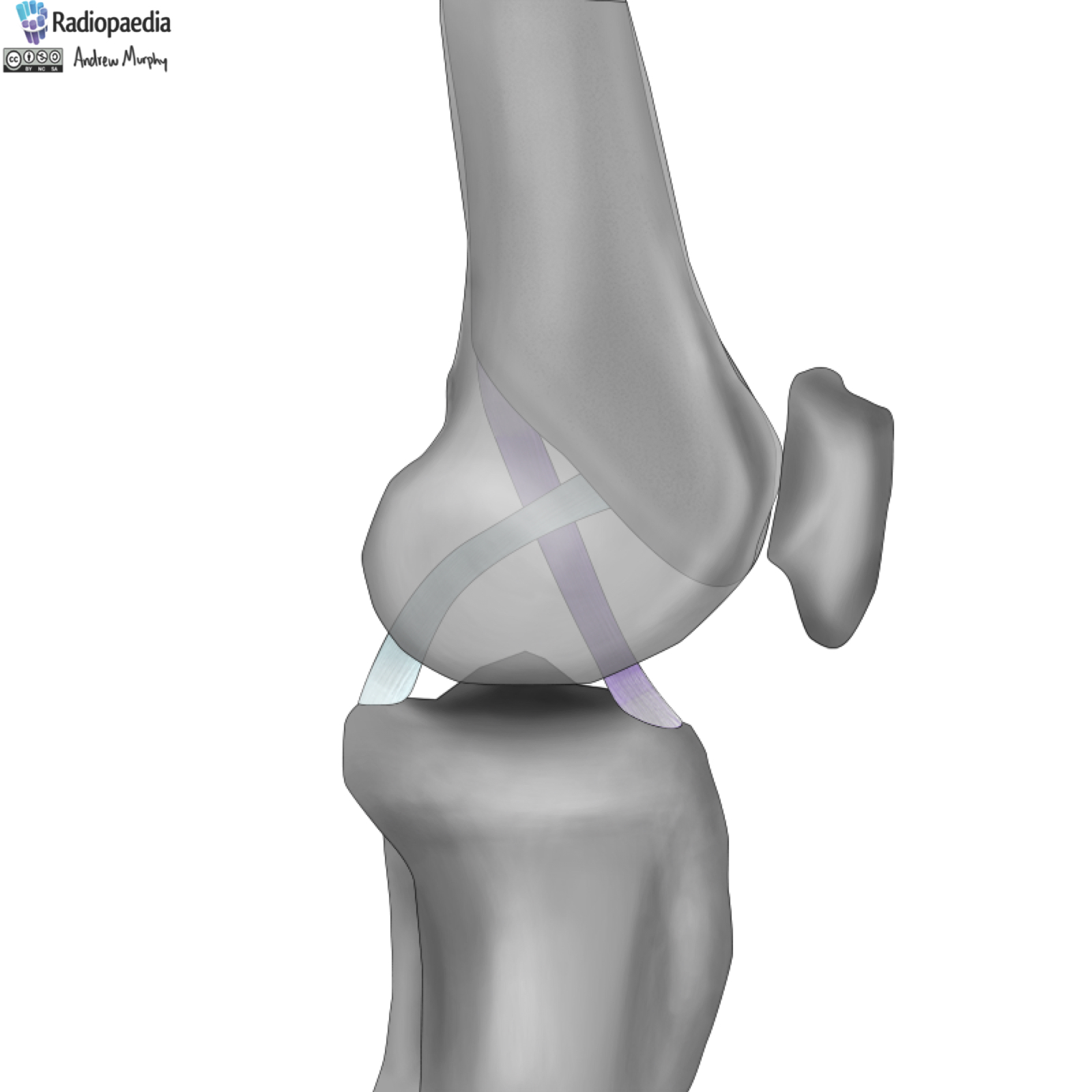 Radiopaedia - Drawing Anterior and posterior cruciate ligaments of knee ...