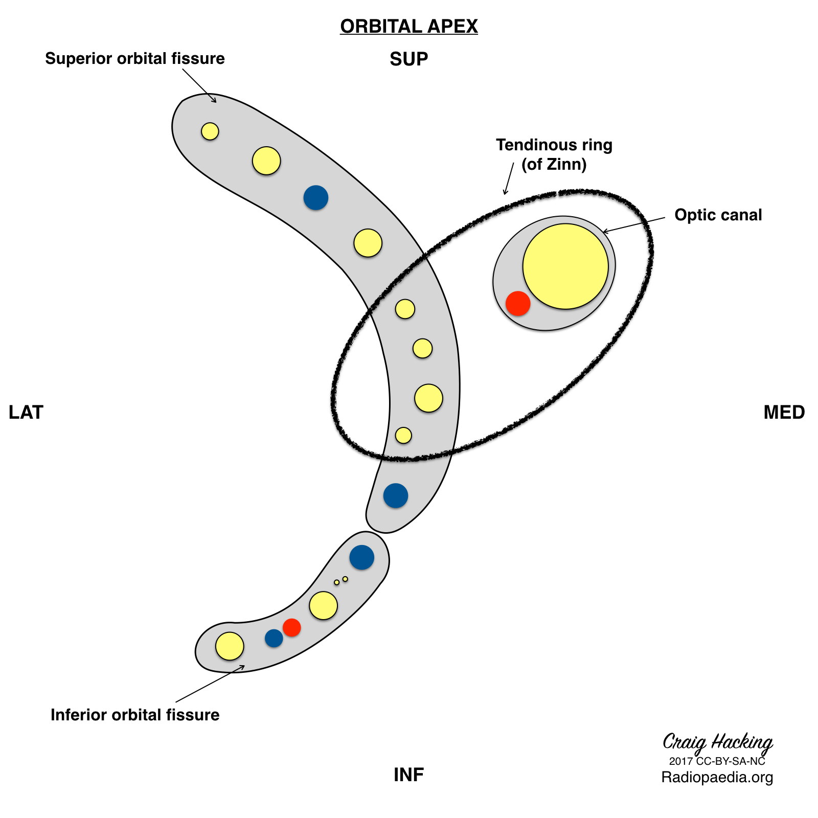 Radiopaedia - Drawing Nerves and vessels of orbital apex - English ...