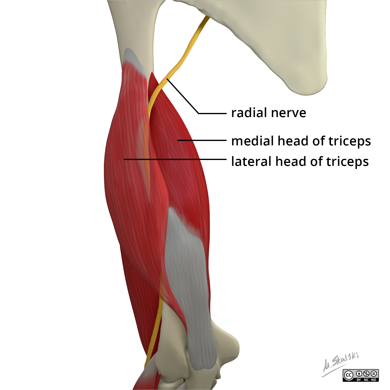 Radiopaedia - Drawing Radial nerve at humerus posterior view - English ...
