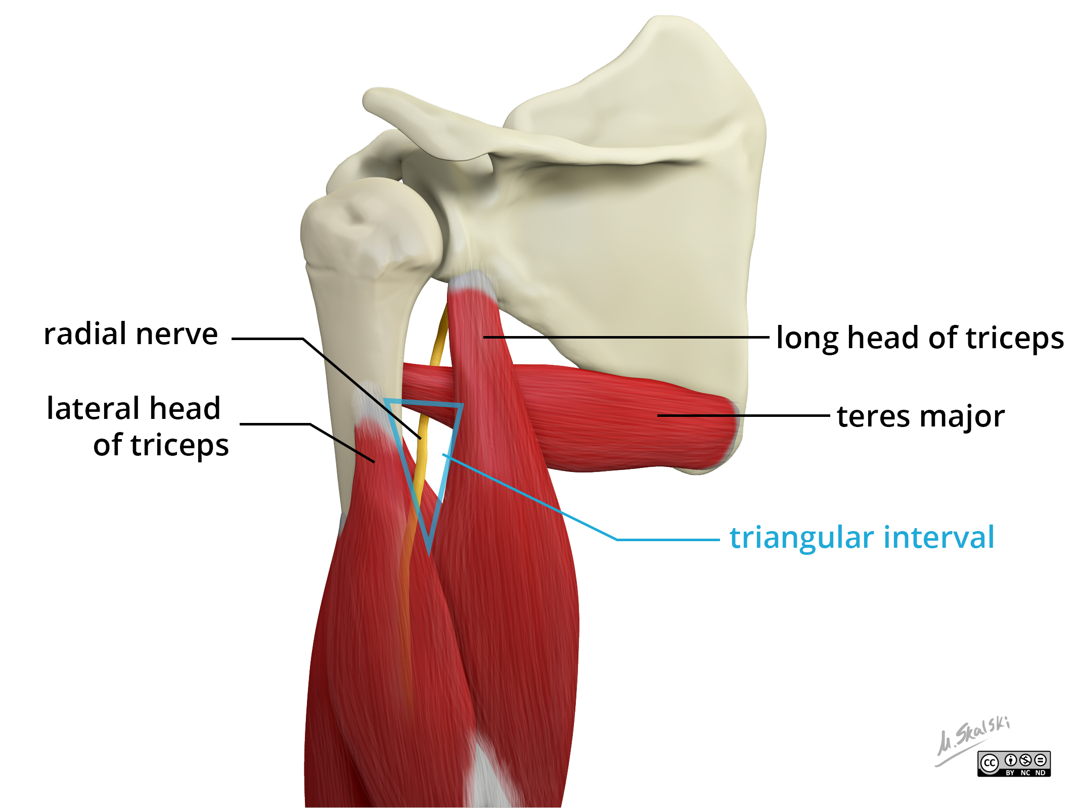 Radiopaedia - Drawing Radial nerve at shoulder - English labels ...