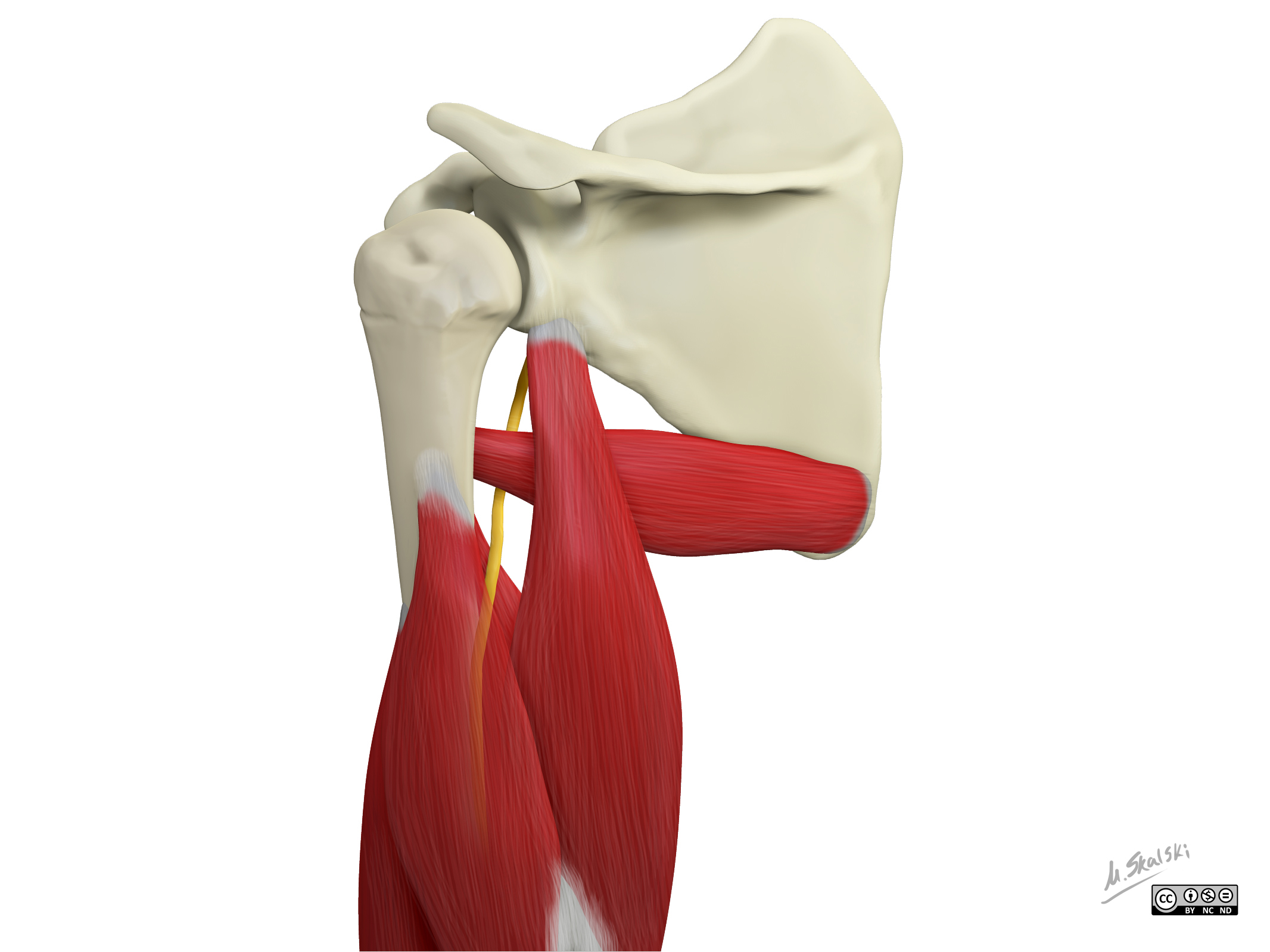 Radiopaedia - Drawing Radial nerve at shoulder - no labels | AnatomyTOOL
