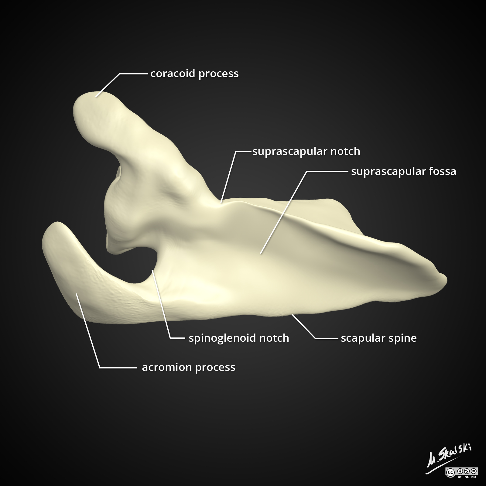 Radiopaedia - Drawing Scapula superior view - English labels | AnatomyTOOL