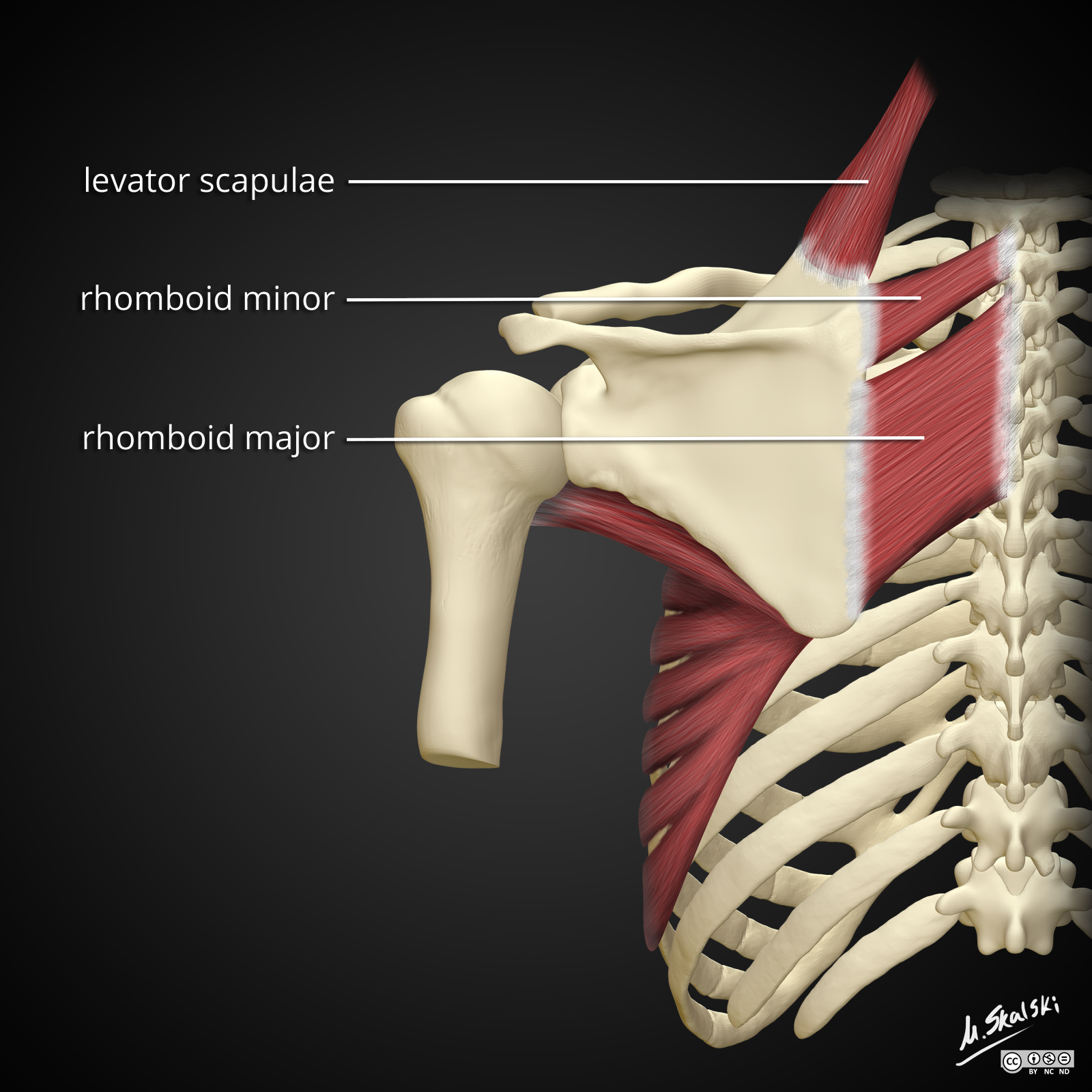 Radiopaedia - Drawing Levator scapulae and rhomboid muscles - English ...