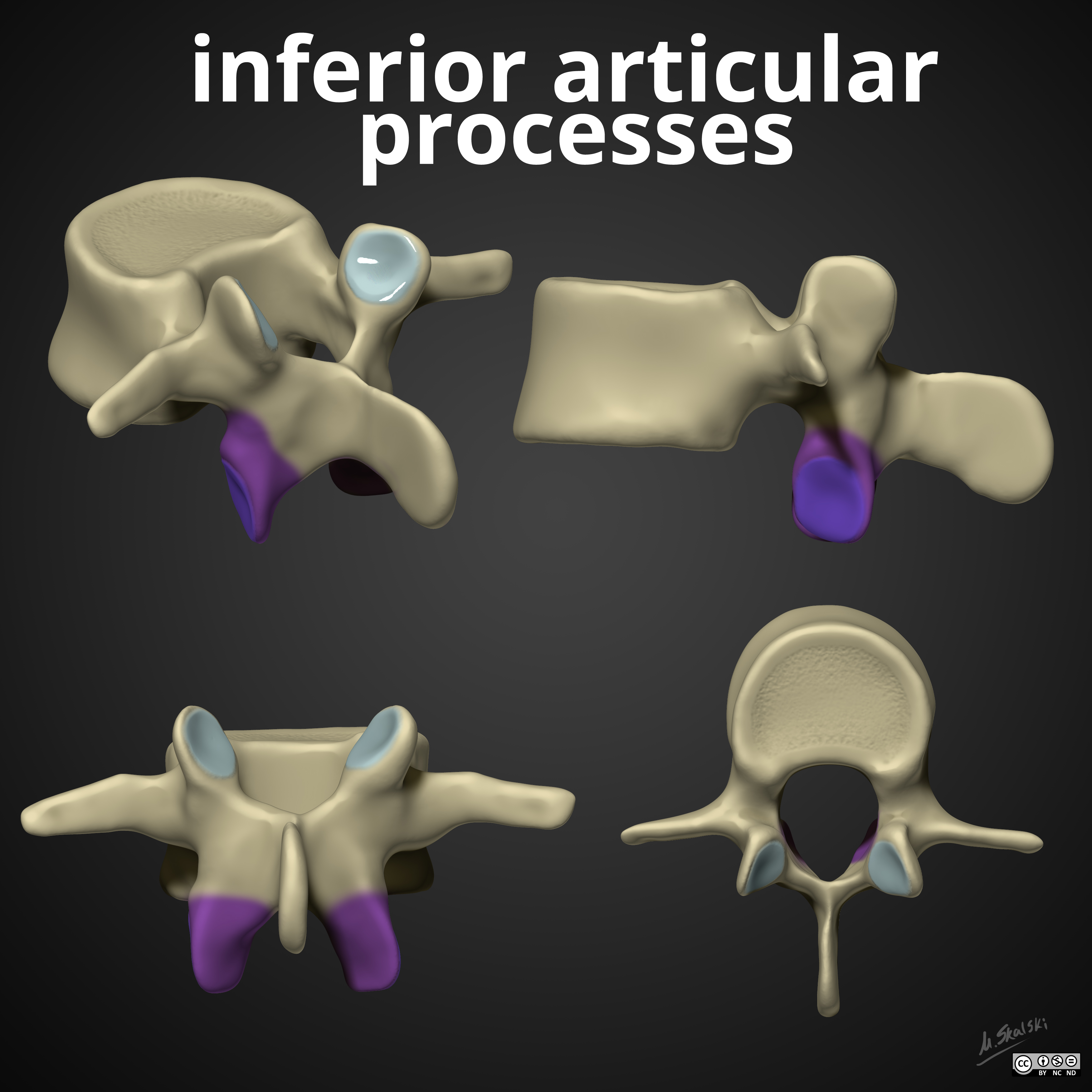 Radiopaedia - Drawing Inferior articular process - no labels | AnatomyTOOL
