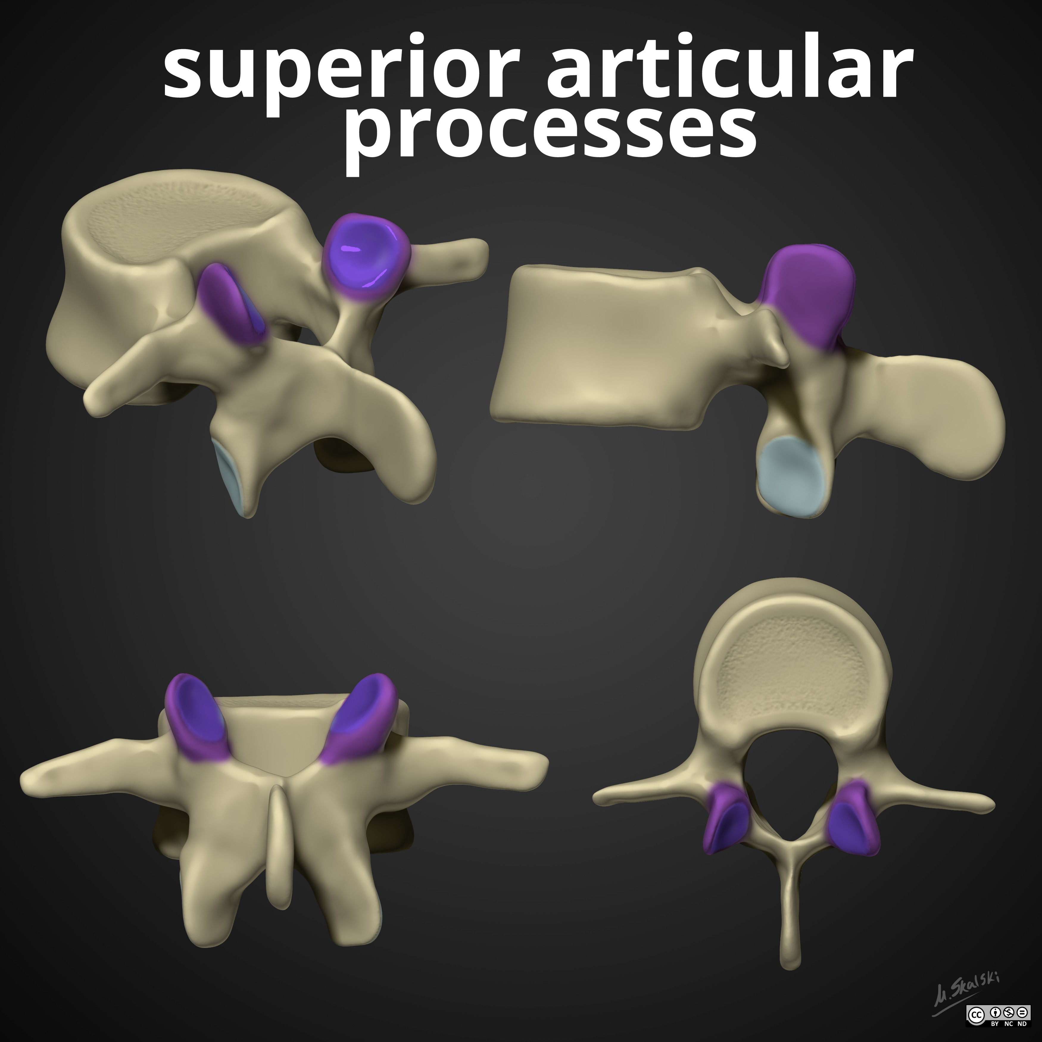 Radiopaedia - Drawing Superior articular process - no labels | AnatomyTOOL