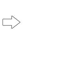 Radiopaedia - Drawing Suprameatal triangle (mastoid fossa; MacEwen ...